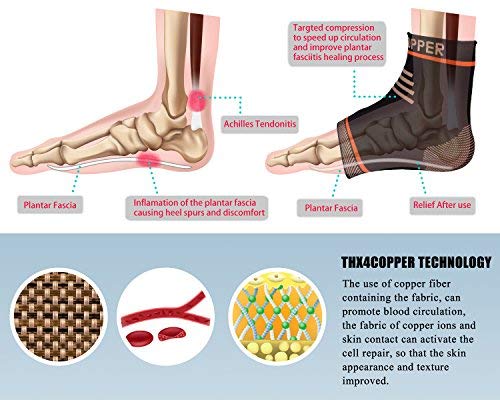 THX4COPPER Infused Compression Ankle Brace,Silicone Ankle Sleeve Support,Pain Relief from Plantar Fasciitis, Achilles Tendonitis-Reduce Foot Swelling&Prevent Ankle Injuries-Single-Small