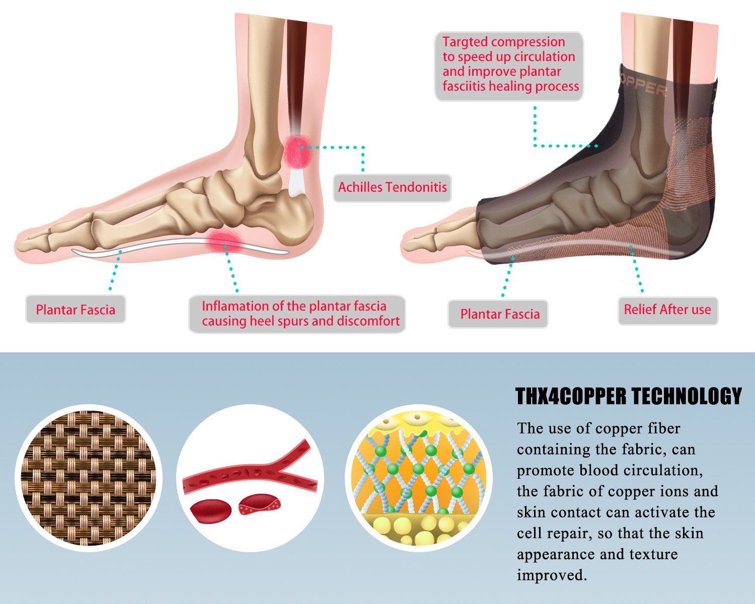 THX4COPPER Compression Recovery Foot Sleeve for Men&Women, Copper Infused Plantar Fasciitis Socks for Arch Pain, Reduce Swelling & Heel Spurs, Ankle Sleeve with Arch Support - Medium