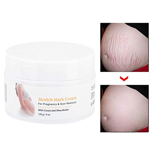Stretch Mark Cream, Postpartum Obesity Cream, Remove Stretch Marks, Repair Scar Slack Line Abdomen Stretch Marks Postpartum 120g