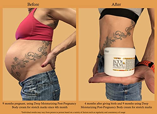 Stretch Mark Remover Cream | Firming, Hydrating, Tightening, Improves Skin Elasticity | Deep Moisturizing Post-Pregnancy Body cream for stretch marks | Naturally-Sourced Extracts and Oils Formula