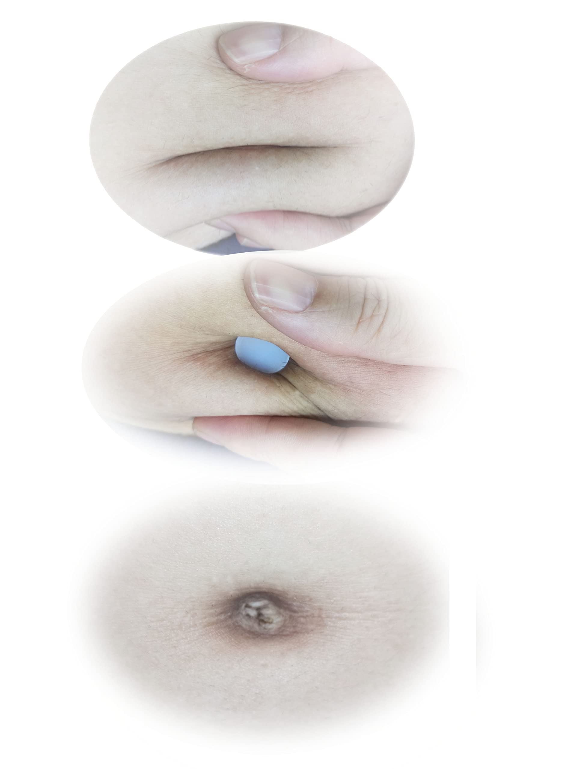 Youtuho Soft Belly Button Plug Post Tummy Tuck(5PCS Different Sizes) Belly Button Marble Effect White, Large Medium small