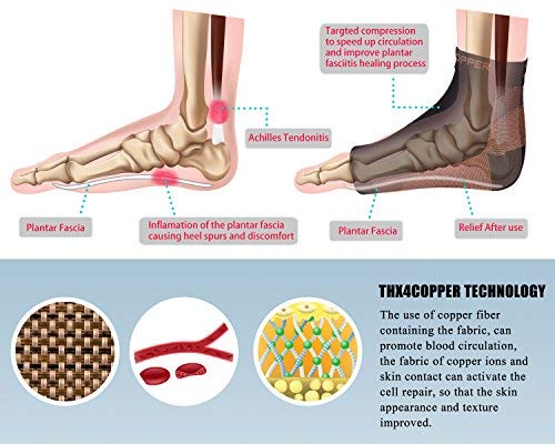 Thx4 Copper Compression Recovery Foot Sleeves for Men & Women, Copper Infused Plantar Fasciitis Socks for Arch Pain, Reduce Swelling & Heel Spurs, Ankle Sleeve with Arch Support-X-Large