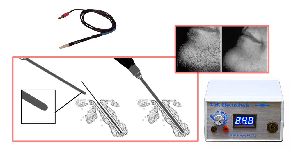 V2R Electrolysis System for Permanent Hair Removal with Accessory Kit.