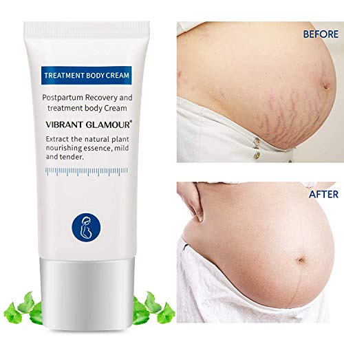 Stretch marks cream for pregnancy- Organic Plant Extracts - Effective Stretch Mark & Scar Treatment - Massage Cream for Pregnancy Skincare 0.5 Fl Oz11