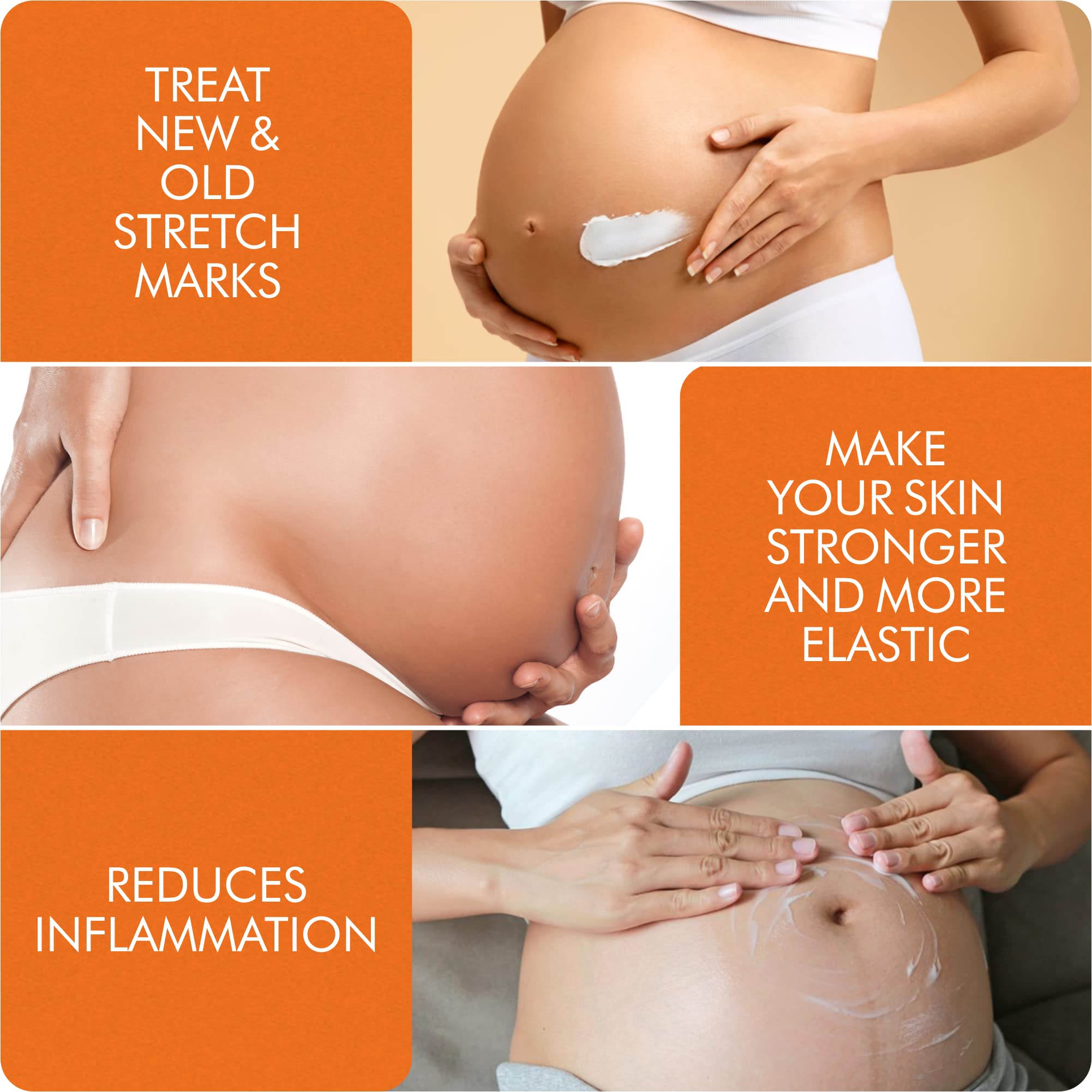 V.SACHAR MD Maternity Stretch Mark Cream: Effective Stretch Mark Treatment for Preventing & Erasing Stretch Marks | 4 Fl Oz