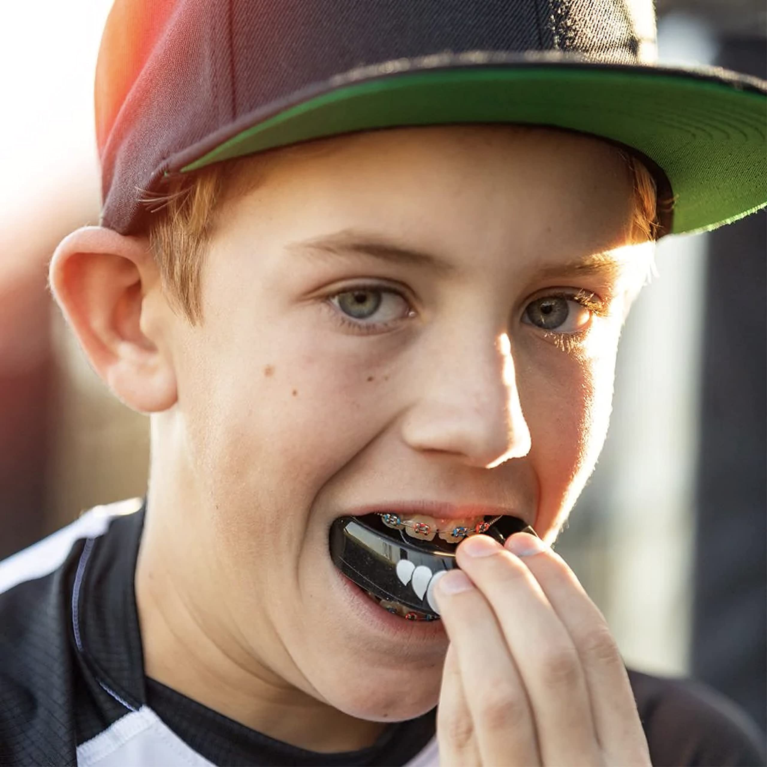 Shock Doctor Upper & Lower Mouth Guard for Braces w/Helmet Strap, Teeth Protection for Football Helmet, Adult & Youth Sizes