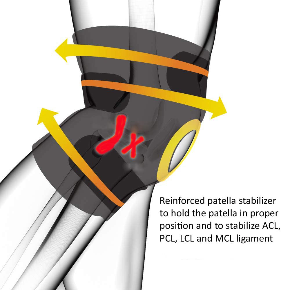 Z ONE Neoprene Open-Patella Knee Support for Arthritis, Joint Pain Relief, Injury Recovery with Adjustable Strapping & with Breathable Neoprene Material (Free Size) (2)