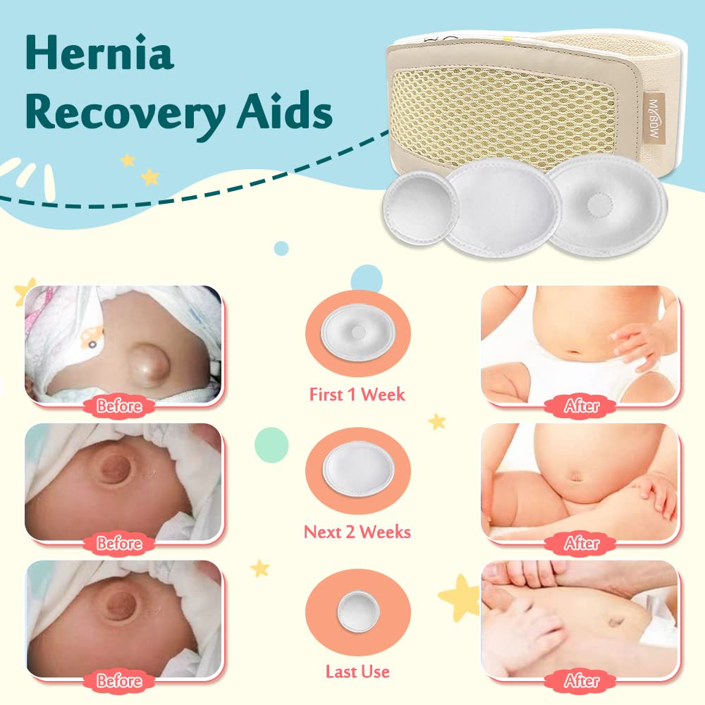 Umbilical Hernia Belt Baby Belly Button Band Infant Newborn Belly Support Band Wrap Baby Abdominal Binder Umbilical Truss Cord Adjustable Navel Band - Medium